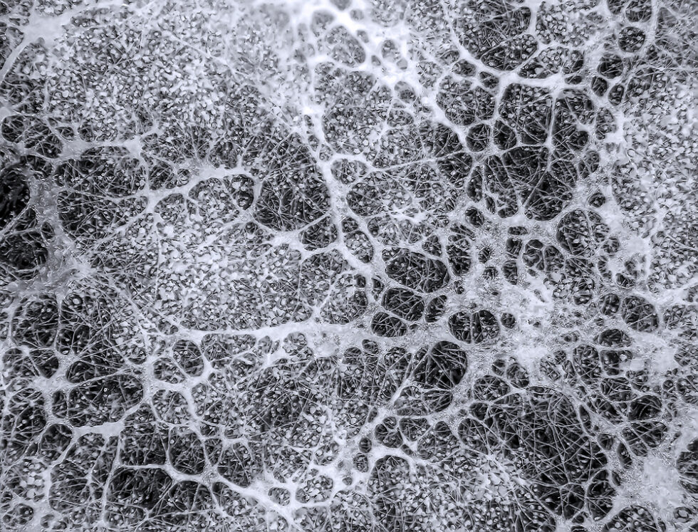 Aluminum Toxicity in Our Soils | ANDAMAN AG